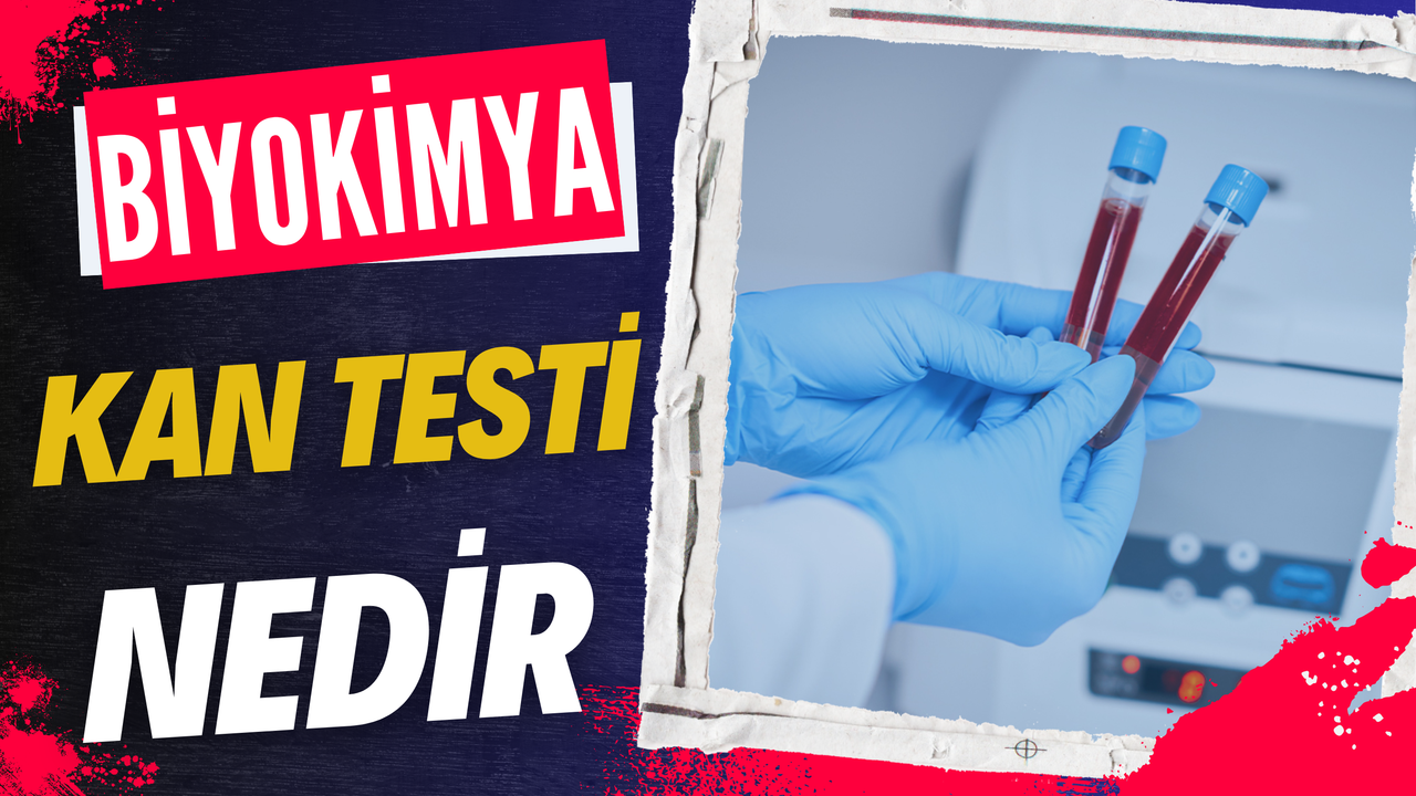 Biyokimya Kan Testi Nedir - Urfa Haberleri