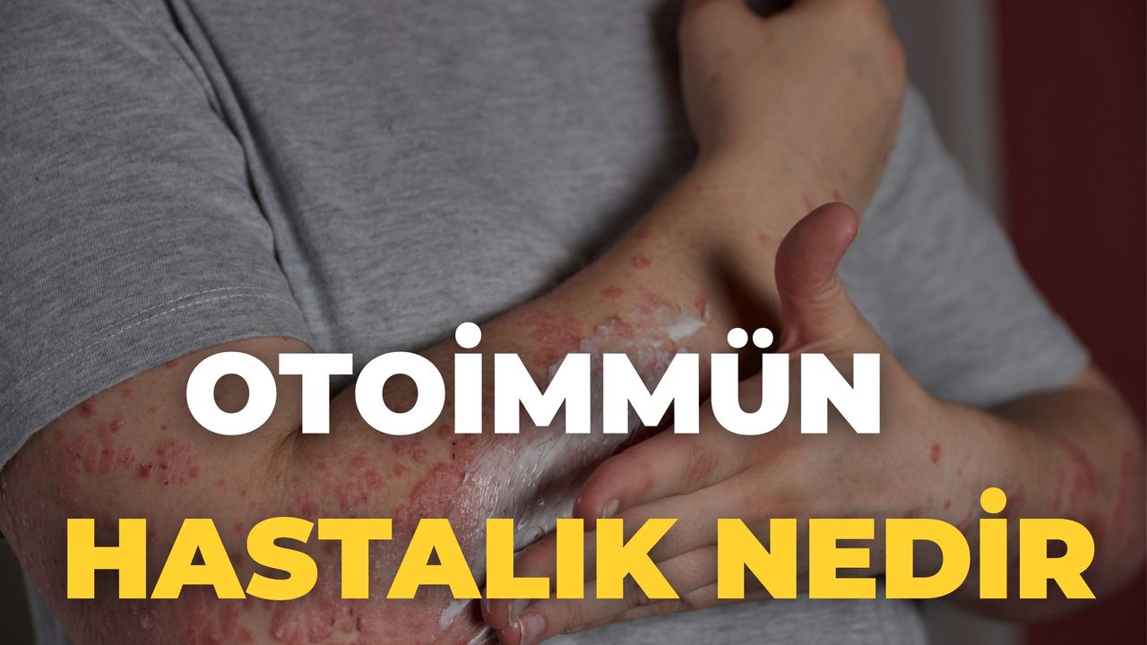 Otoimmün Hastalık Nedir - Urfa Haberleri