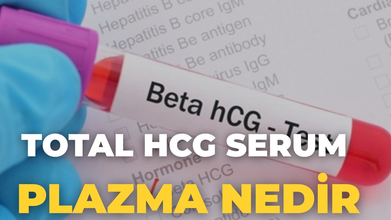 Total Hcg Serum Plazma Nedir - Urfa Haberleri