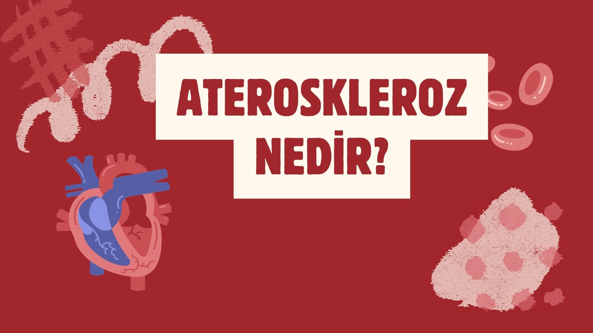 Ateroskleroz Nedir? - Urfa Haberleri