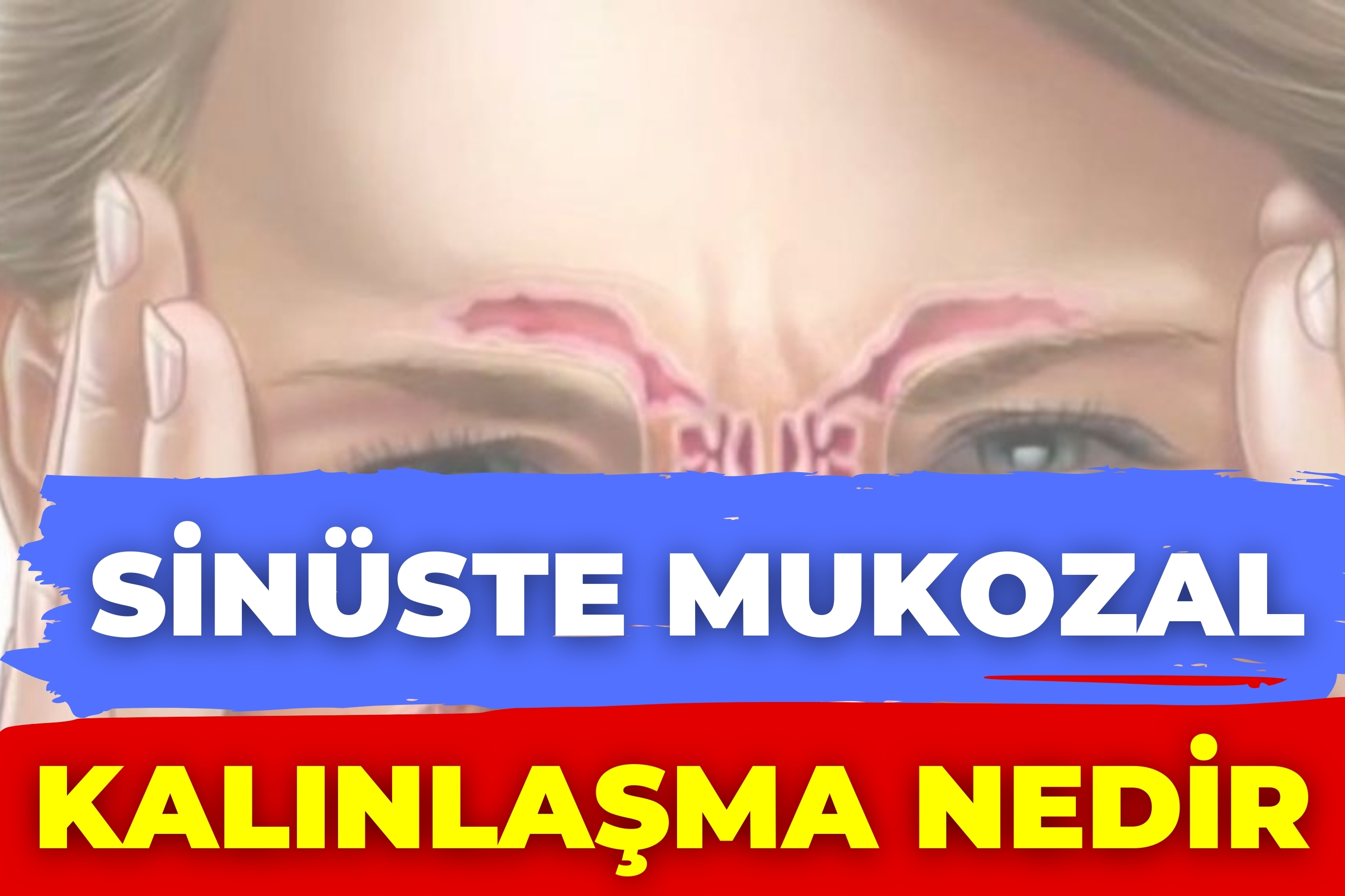 Sinüste Mukozal Kalınlaşma Nedir - Urfa Haberleri