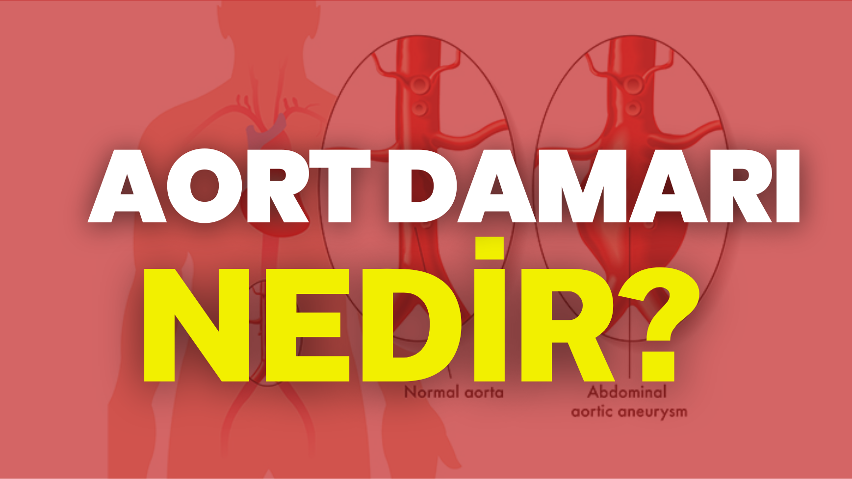 Aort Damarı Nedir? Aort Damarı Neden Yırtılır? - Urfa Haberleri