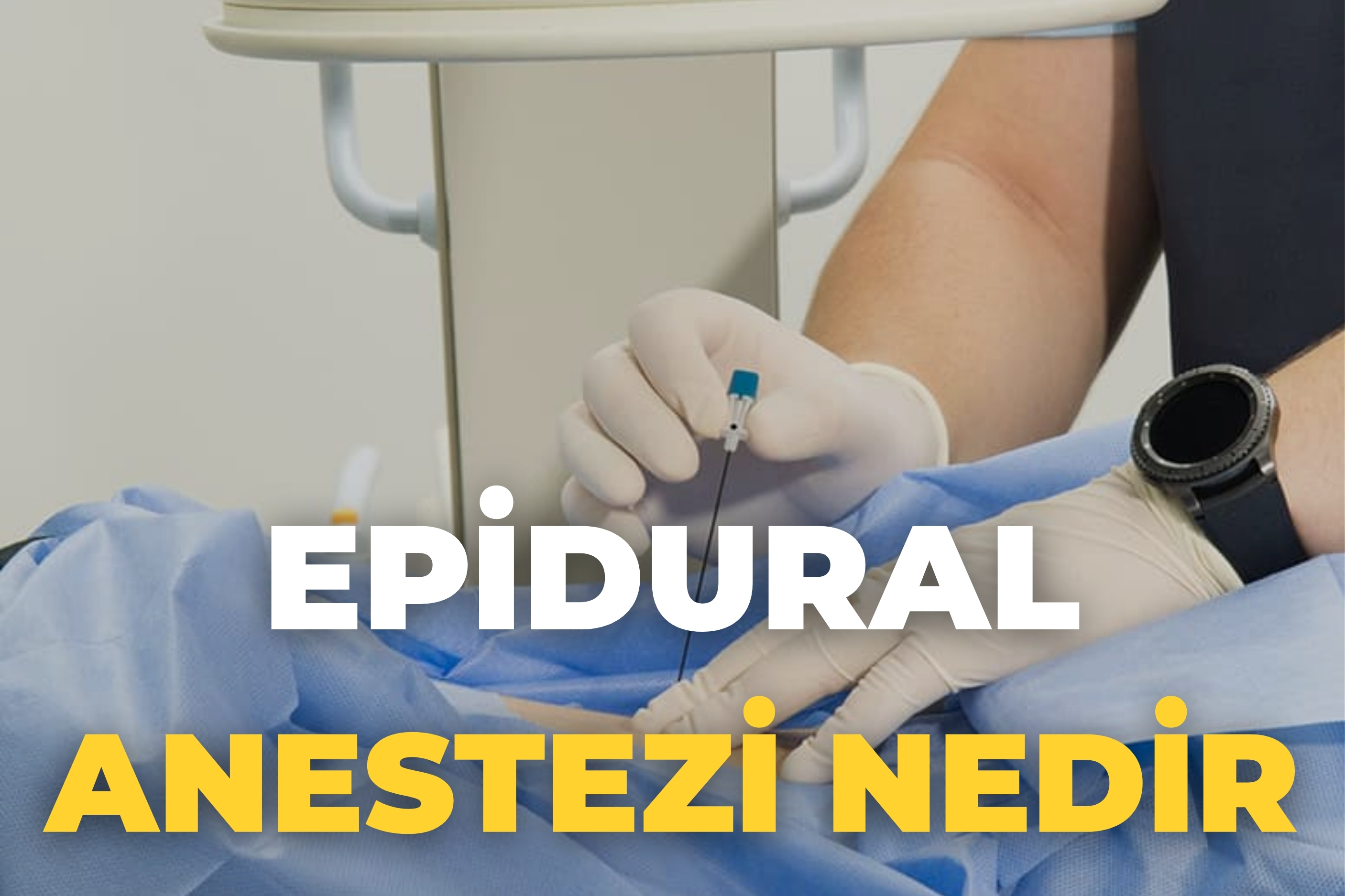 Epidural Anestezi Nedir - Urfa Haberleri