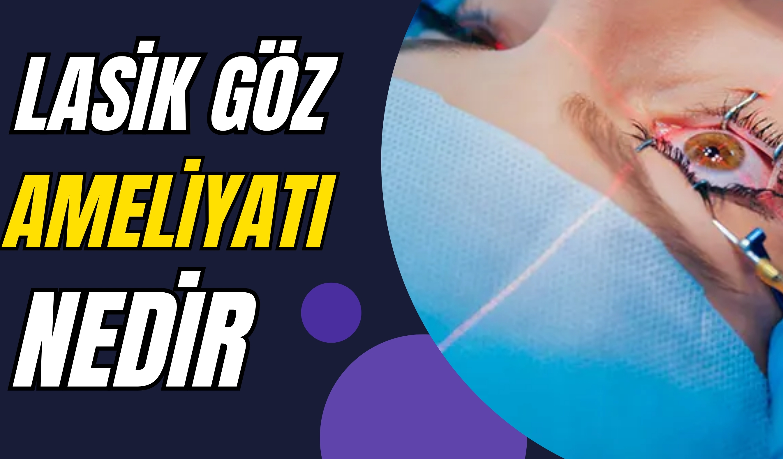 Lasik Göz Ameliyatı Nedir - Urfa Haberleri